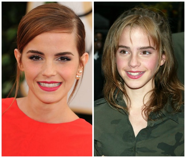Era uratica si cu dintii strambi. Cum arata Emma Watson cand a debutat ...