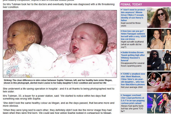 Fotografia care I-A SALVAT VIATA. Diferenta dintre doua surori gemene ...